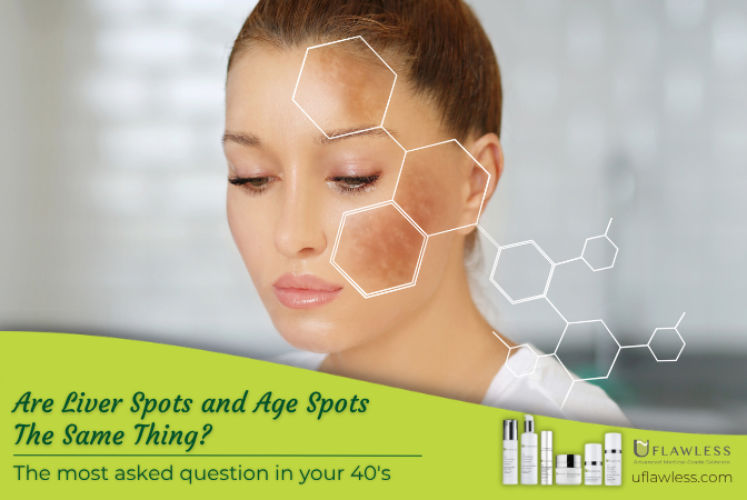 Are Liver Spots and Age Spots the Same Thing? – UFlawless